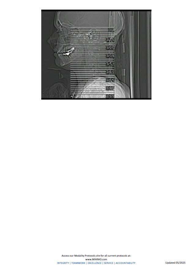 CT C Spine Without Contrast