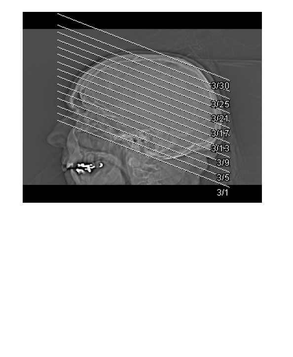 CT Head With Contrast