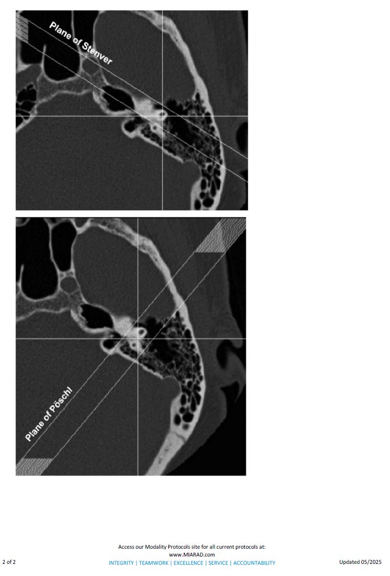 CT Temporal Bone With Contrast